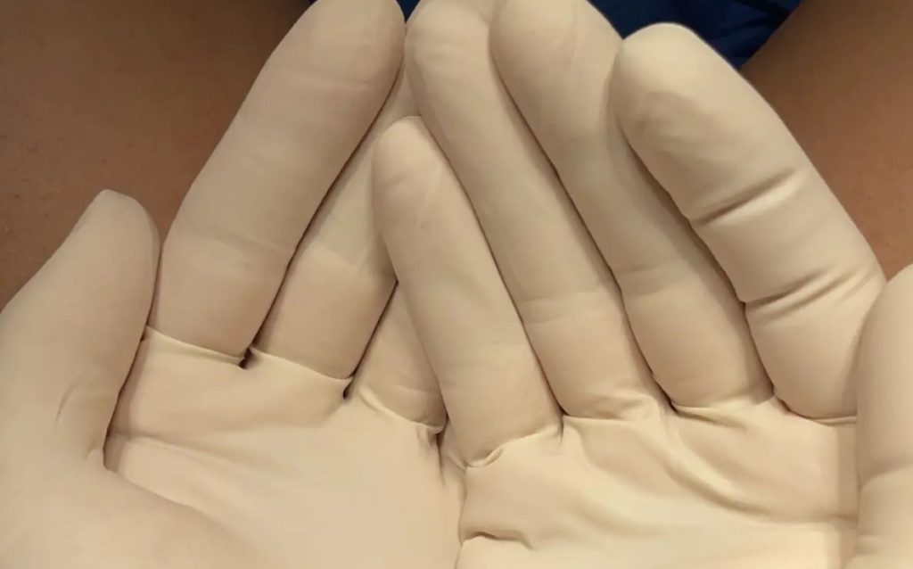 Labiaplasty Surgery - The Labiaplasty